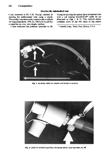 (PDF) Securing the endotracheal tube