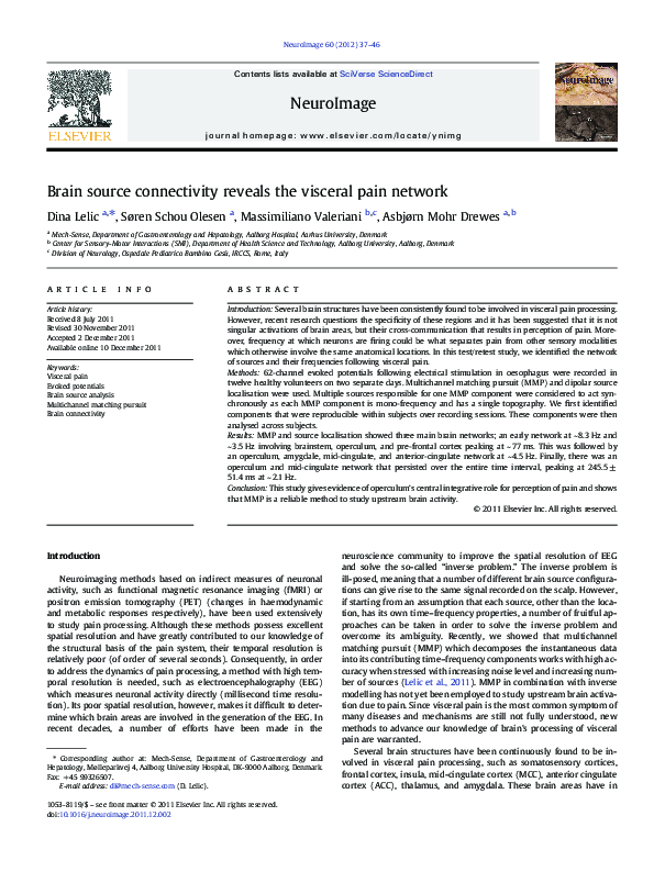 (PDF) Brain source connectivity reveals the visceral pain network