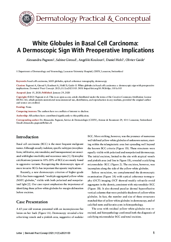 (PDF) White Globules in Basal Cell Carcinoma: A Dermoscopic Sign With ...