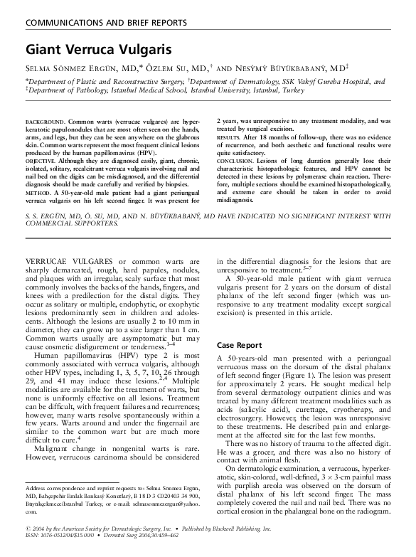 (PDF) Giant Verruca Vulgaris