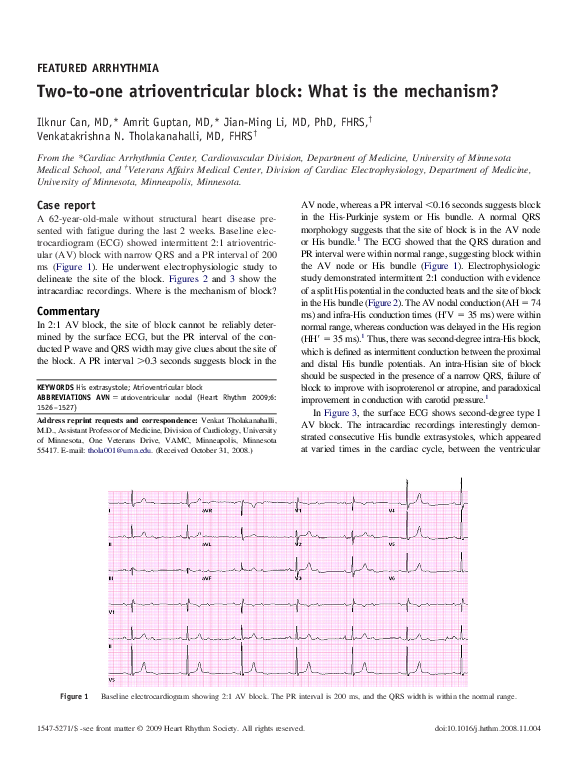 (PDF) Two-to-one atrioventricular block: What is the mechanism?