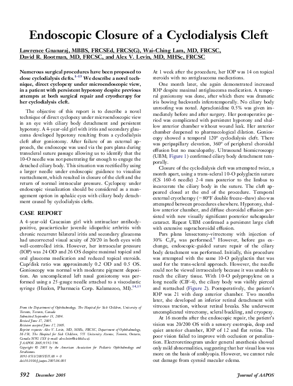 (PDF) Endoscopic Closure of a Cyclodialysis Cleft