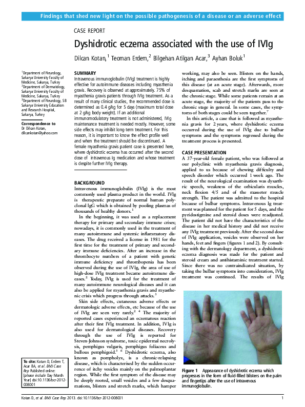 (PDF) Dyshidrotic eczema associated with the use of IVIg