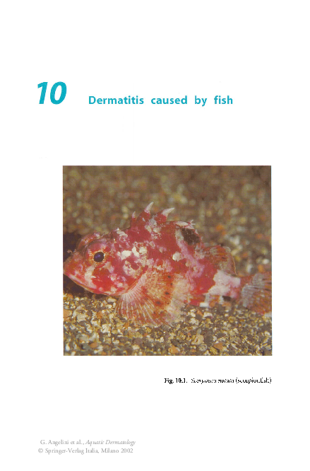 (PDF) Dermatitis caused by fish