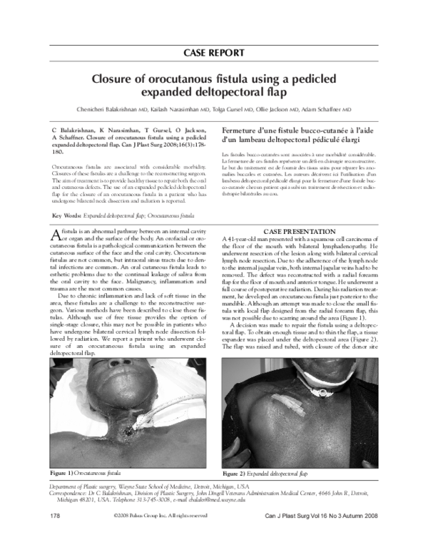 (PDF) Closure of orocutanous fistula using a pedicled expanded ...
