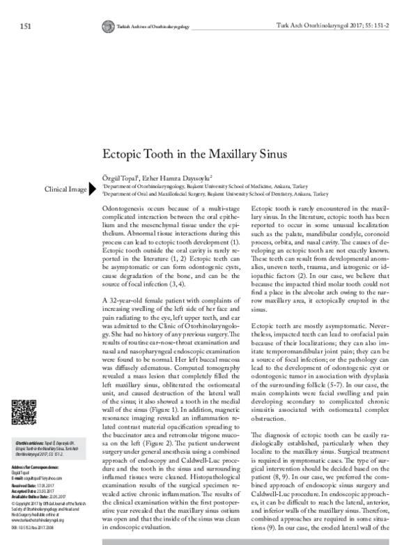 (PDF) Ectopic Tooth in the Maxillary Sinus