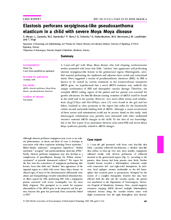 (PDF) Elastosis perforans serpiginosa-like pseudoxanthoma elasticum in ...