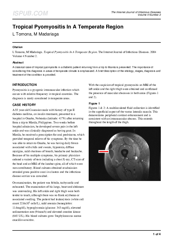 (PDF) Tropical Pyomyositis In A Temperate Region