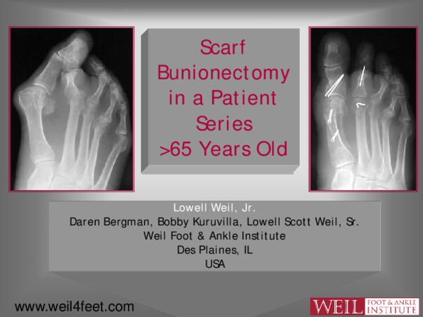 (PDF) Scarf Bunionectomy in a Patient Series >65 Years Old