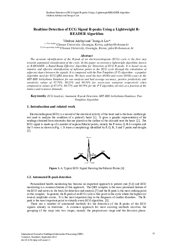 (PDF) Realtime Detection of ECG Signal R-peaks Using a Lightweight RREADER Algorithm