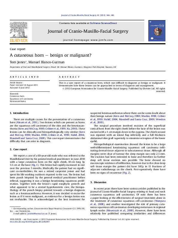 (PDF) A cutaneous horn – benign or malignant?