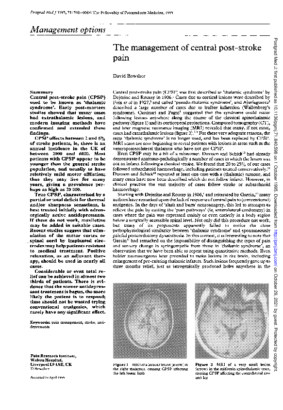 (PDF) The management of central post-stroke pain