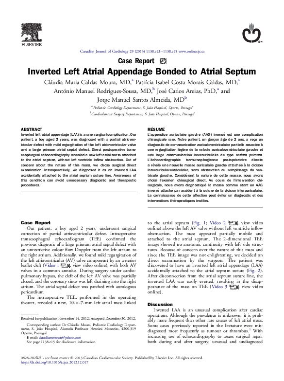 (PDF) Inverted Left Atrial Appendage Bonded to Atrial Septum