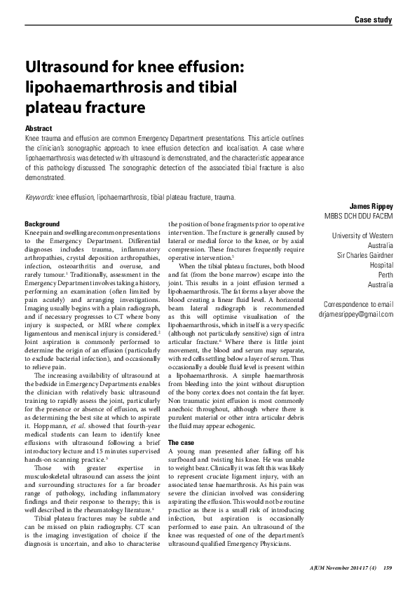(PDF) Ultrasound for knee effusion: lipohaemarthrosis and tibial ...