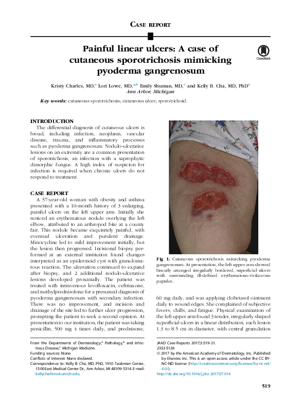 (PDF) Painful linear ulcers: A case of cutaneous sporotrichosis mimicking pyoderma gangrenosum