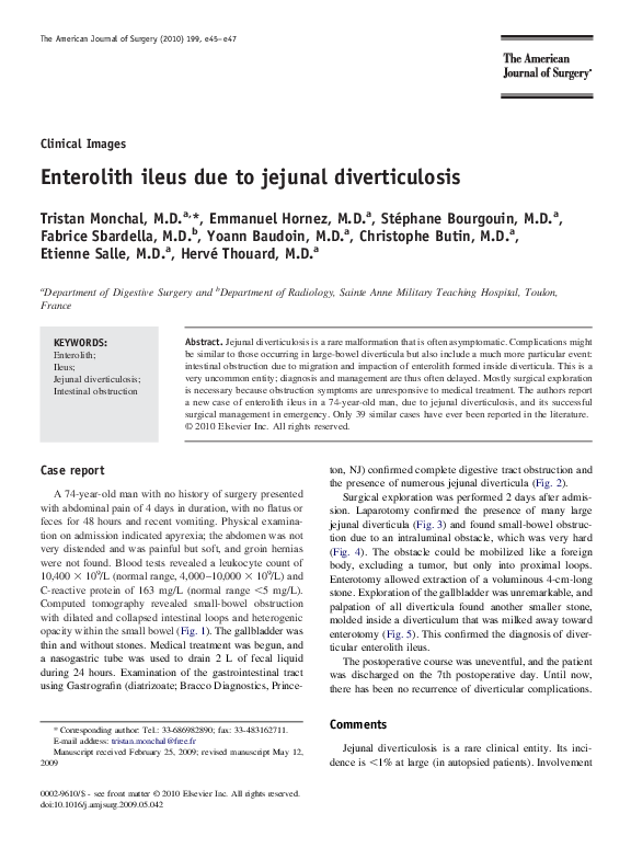 (PDF) Enterolith ileus due to jejunal diverticulosis