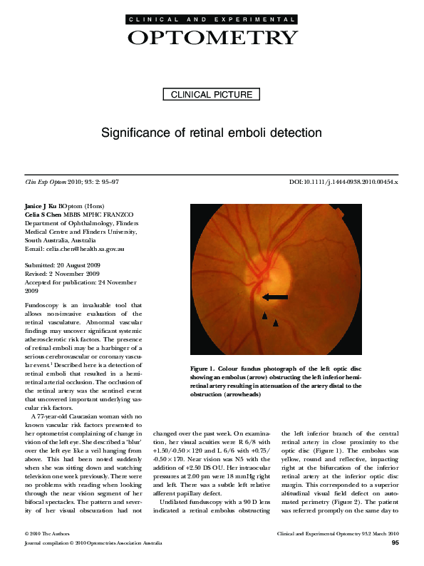 (PDF) Significance of retinal emboli detection