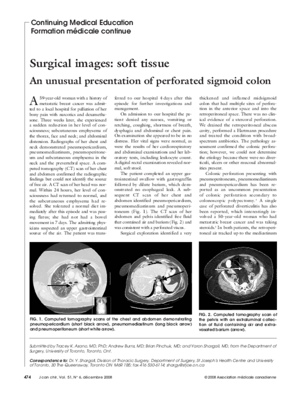 (PDF) Surgical images: soft tissue: an unusual presentation of ...