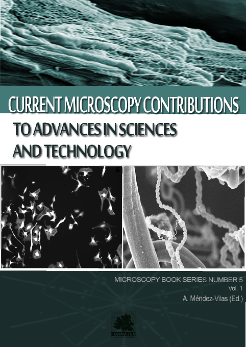(PDF) Use of scanning and transmission electron microscopy to identify ...