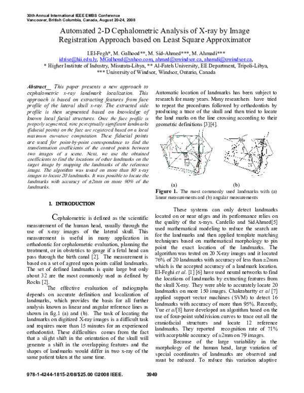 (PDF) Automated 2-D cephalometric analysis of X-ray by image registration approach based on ...