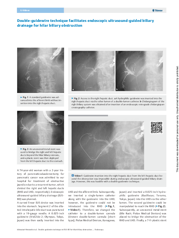 (PDF) Double-guidewire technique facilitates endoscopic ultrasound ...