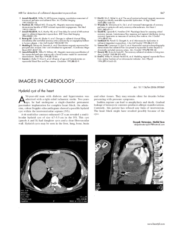 (PDF) Hydatid cyst of the heart
