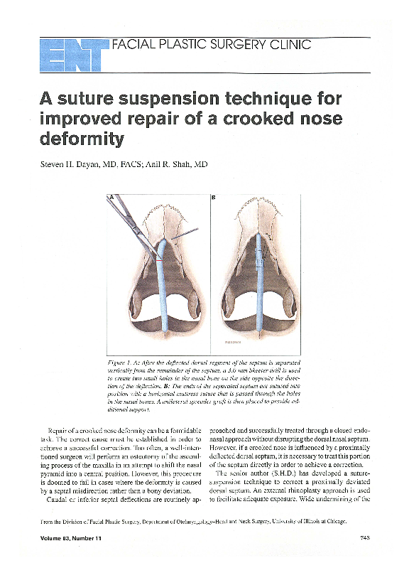 (PDF) A suture suspension technique for improved repair of a crooked ...