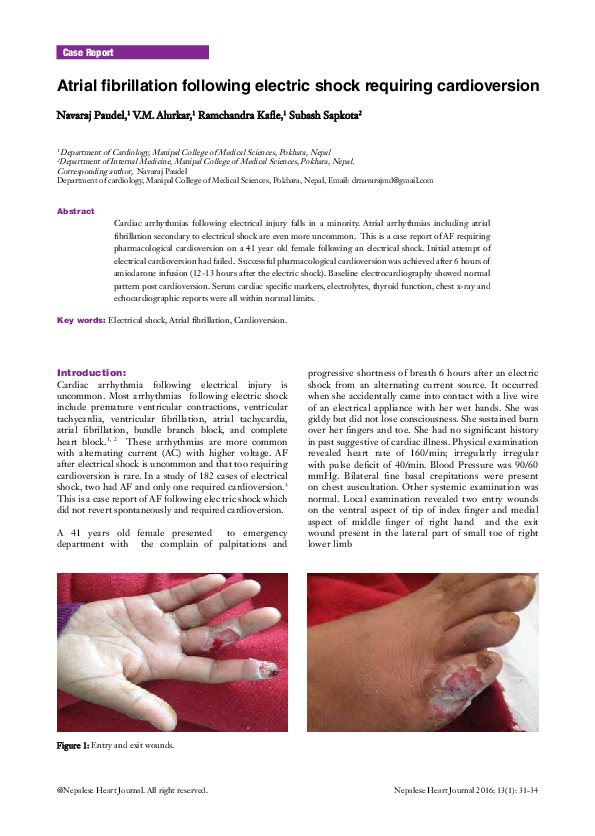 (PDF) Atrial fibrillation following electric shock requiring cardioversion