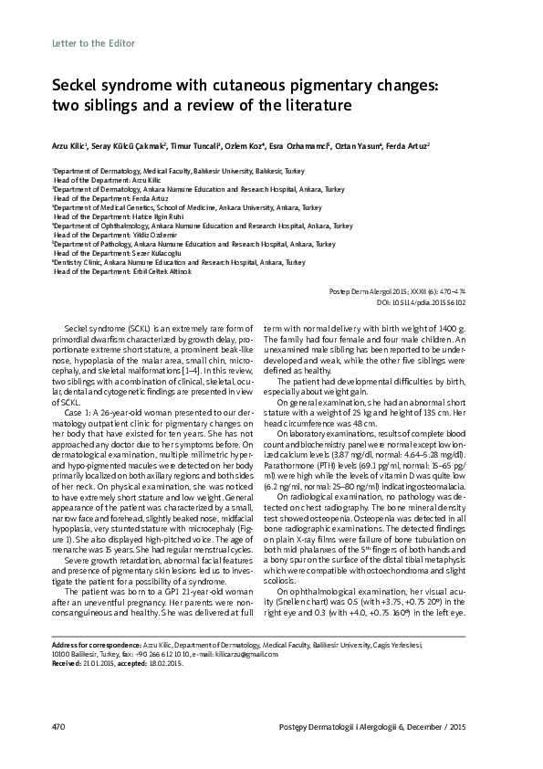 (PDF) Seckel syndrome with cutaneous pigmentary changes: two siblings ...