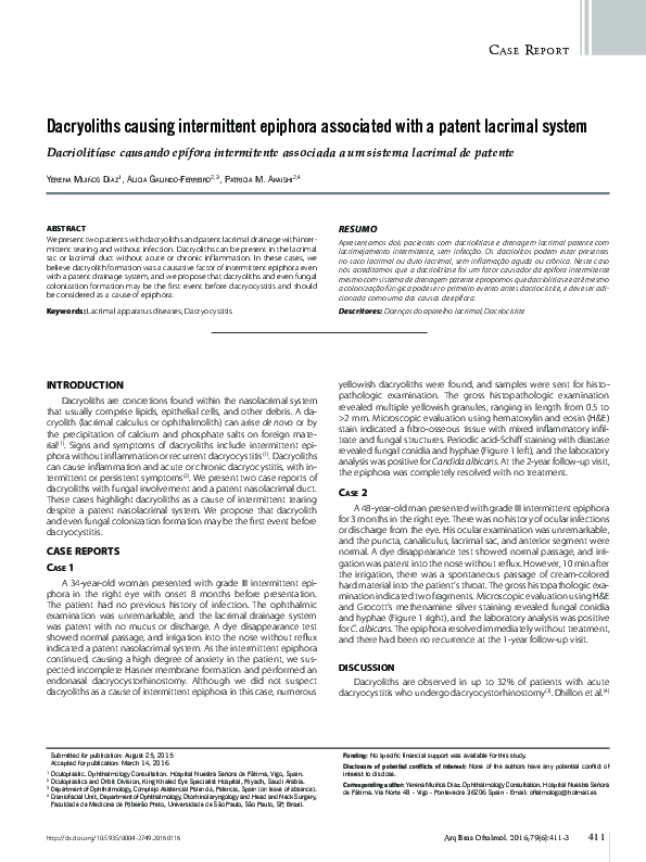(PDF) Dacryoliths causing intermittent epiphora associated with a ...