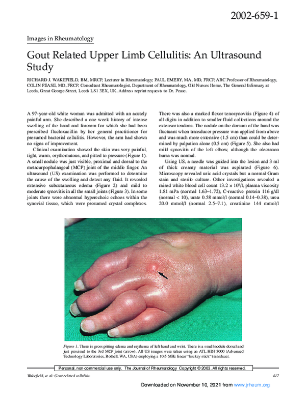 (PDF) Gout related upper limb cellulitis: an ultrasound study