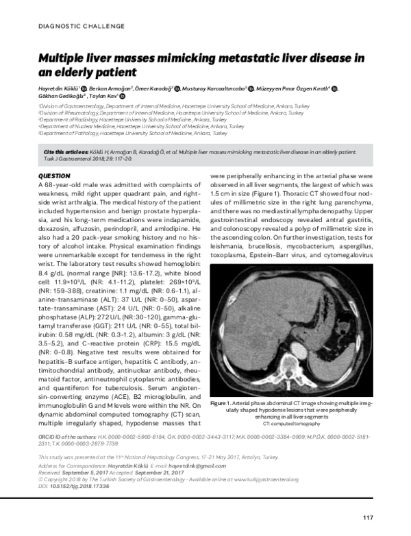 (PDF) Multiple liver masses mimicking metastatic liver disease in an ...