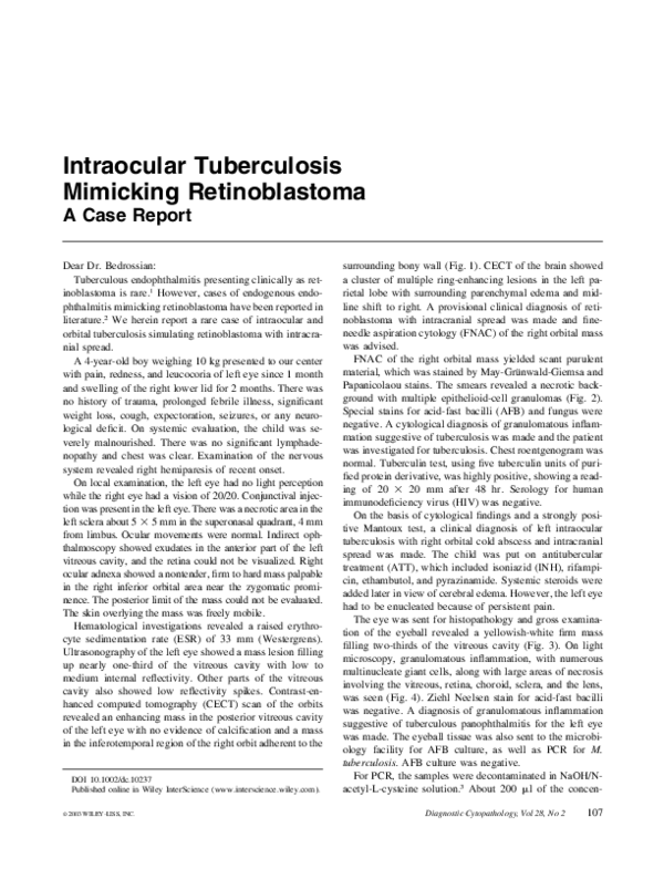 (PDF) Intraocular tuberculosis mimicking retinoblastoma: a case report ...