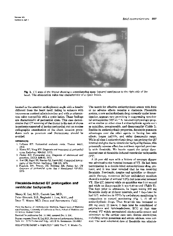 (PDF) Flecainide-induced QT prolongation and ventricular tachycardia