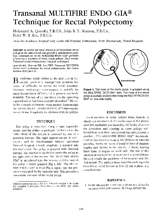 (PDF) Transanal MULTIFIRE ENDO GIA® technique for rectal polypectomy