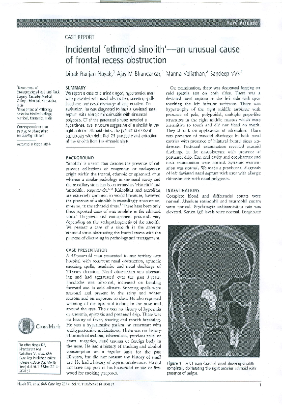 (PDF) Incidental 'ethmoid sinolith'--an unusual cause of frontal recess ...