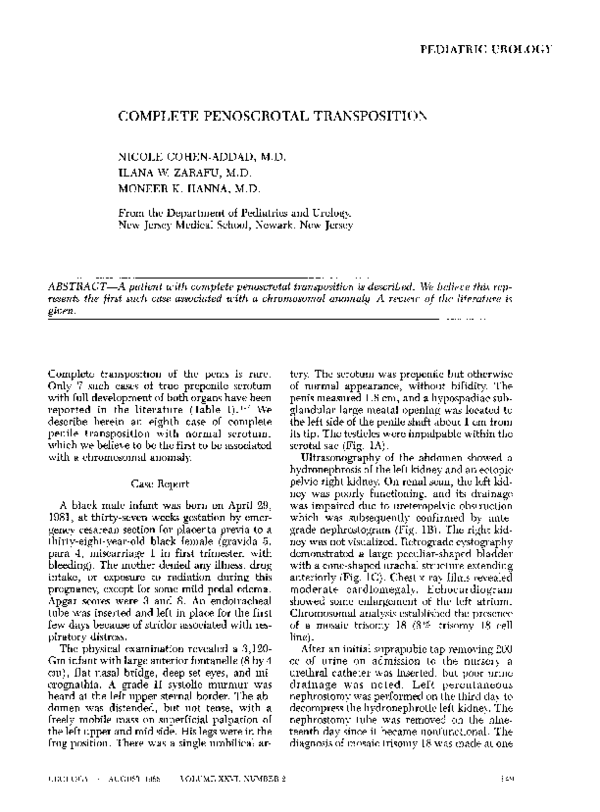 (PDF) Complete Penoscrotal Transposition