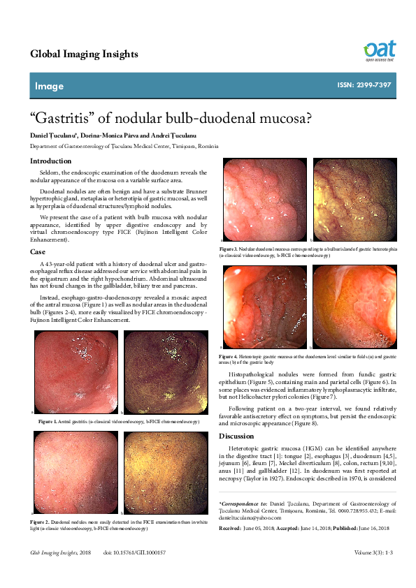 (PDF) Gastritis" of nodular bulb-duodenal mucosa?