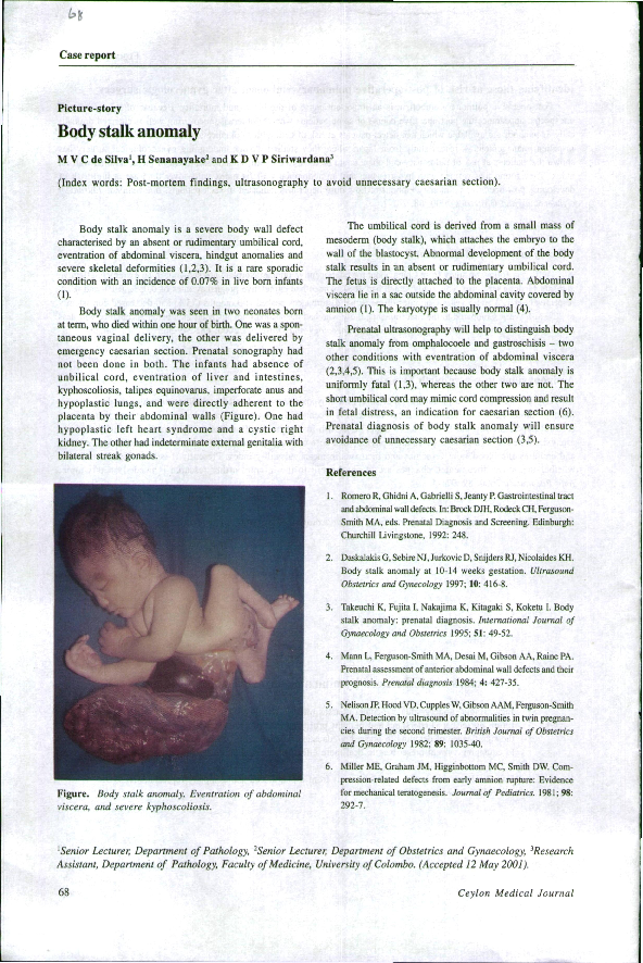 (PDF) Body stalk anomaly