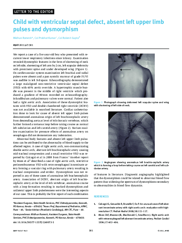 (PDF) Child with ventricular septal defect, absent left upper limb ...