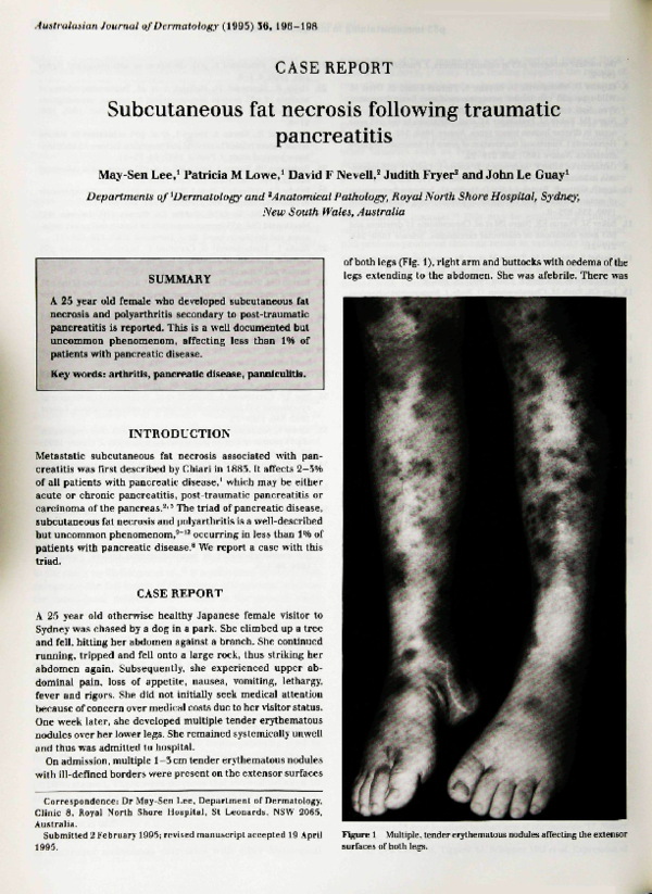 (PDF) Subcutaneous fat necrosis following traumatic pancreatitis ...
