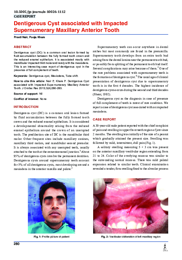 (PDF) Dentigerous Cyst associated with Impacted Supernumerary Maxillary ...