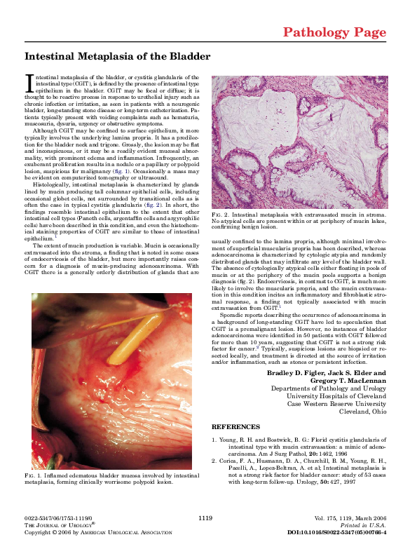 (PDF) Intestinal Metaplasia of the Bladder