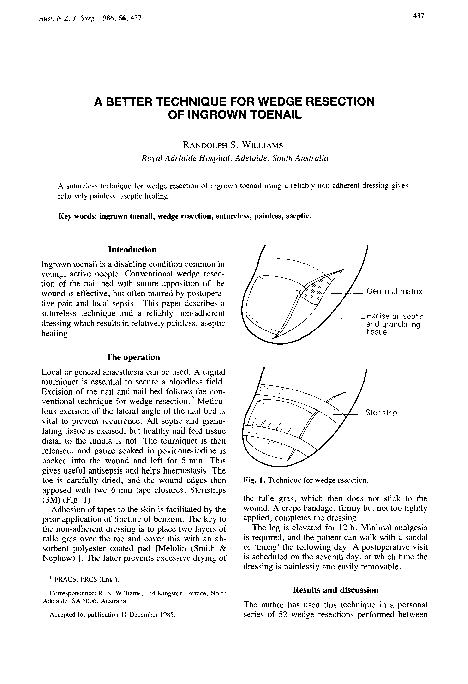 (PDF) A Better Technique for Wedge Resection of Ingrown Toenail ...