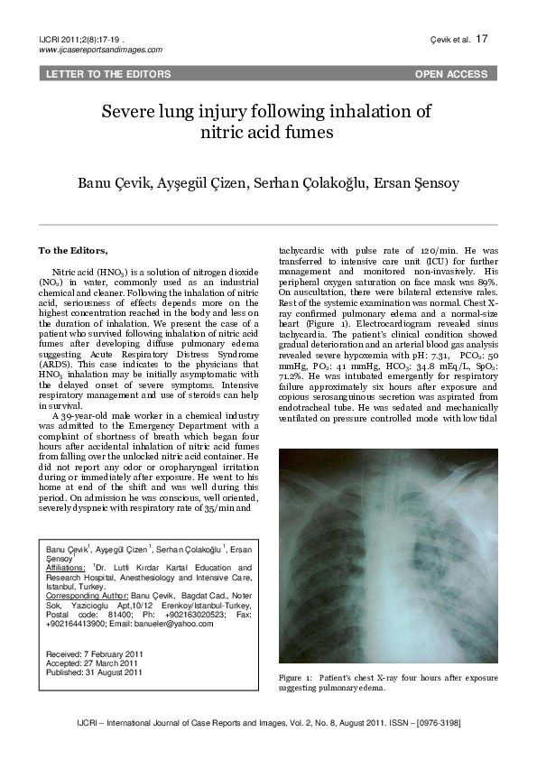 (PDF) Severe lung injury following inhalation of nitric acid fumes