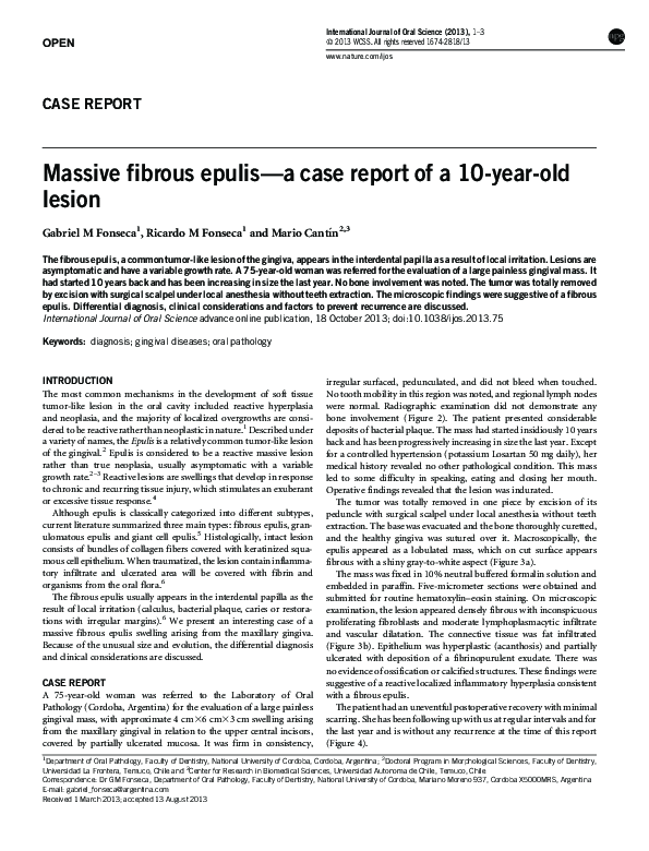(PDF) Massive fibrous epulis—a case report of a 10-year-old lesion