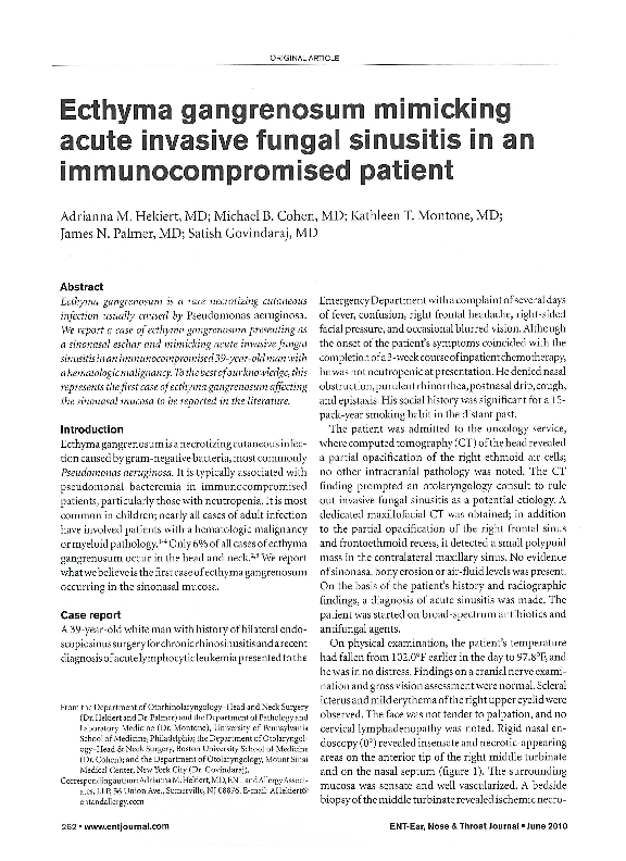(PDF) Ecthyma gangrenosum mimicking acute invasive fungal sinusitis in ...