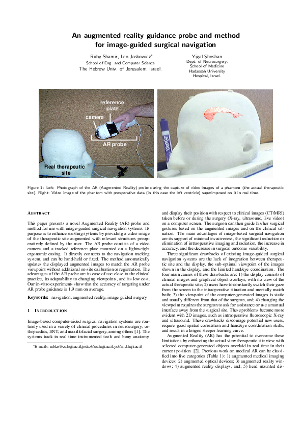 (PDF) An augmented reality guidance probe and method for image-guided ...