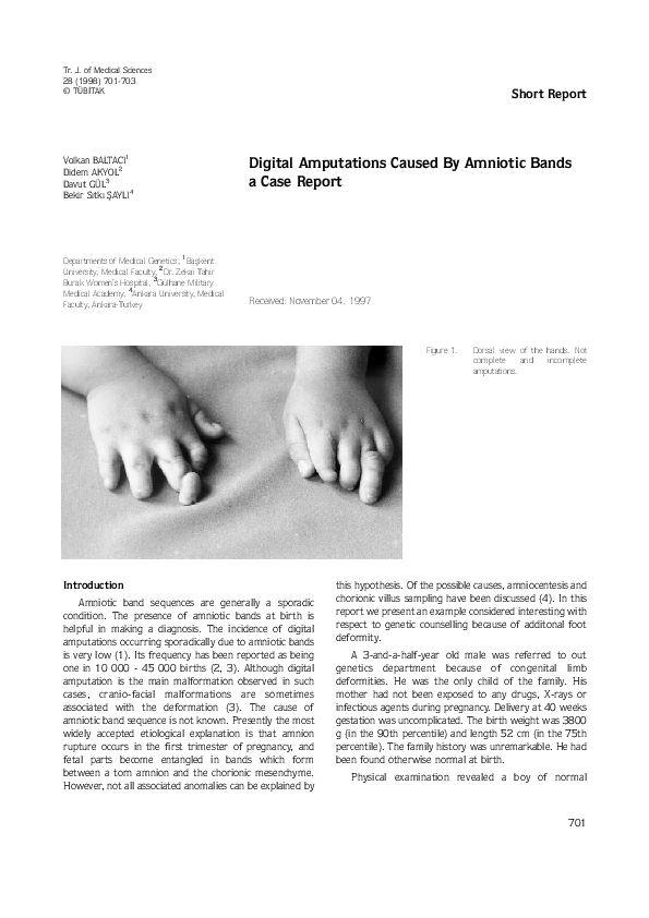 (PDF) Digital Amputations Caused By Amniotic Bands a Case Report