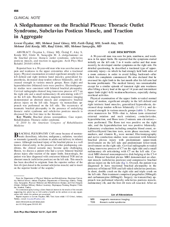 (PDF) A Sledgehammer on the Brachial Plexus: Thoracic Outlet Syndrome ...